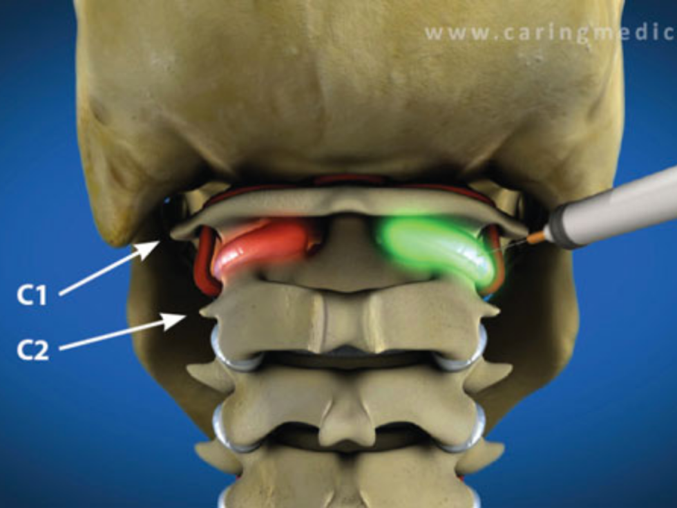 Treatment | CCI Foundation