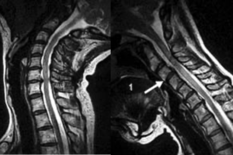 Diagnosis | CCI Foundation